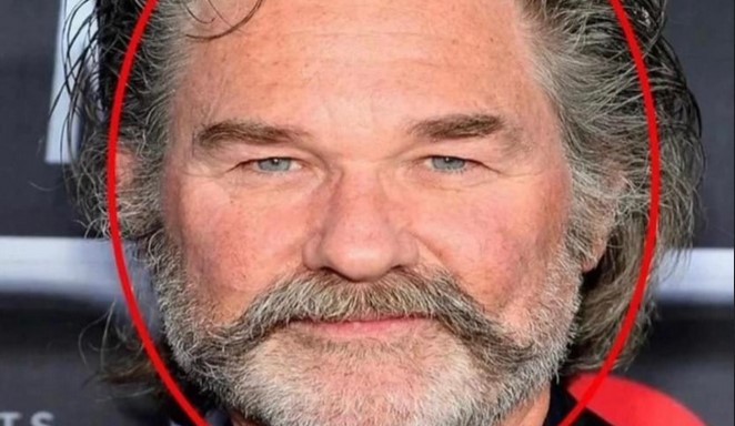 Kurt Russell had what medical conditions? - Top Stories