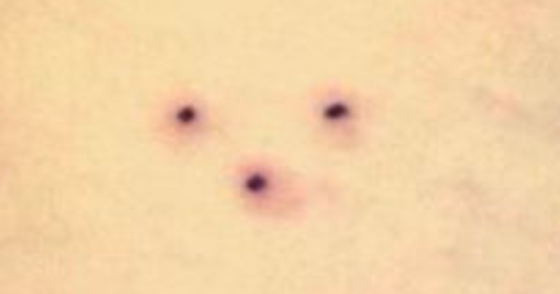 The ‘three-dot tattoo’ – potential meaning and significance - Top Stories